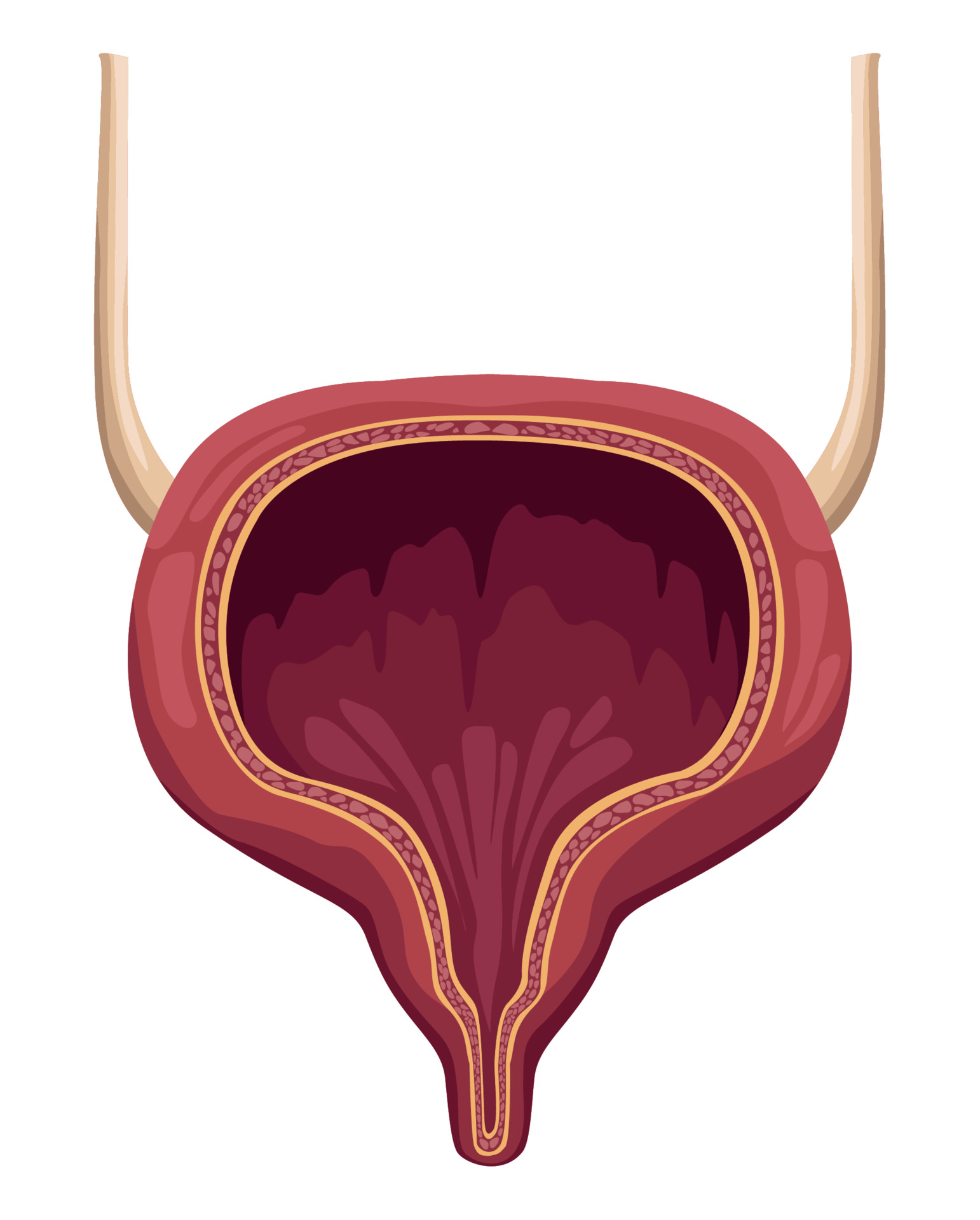 Cystocele ( Bladder Prolapse ) Treatment In Homeopathy | Dr. Thind’s ...